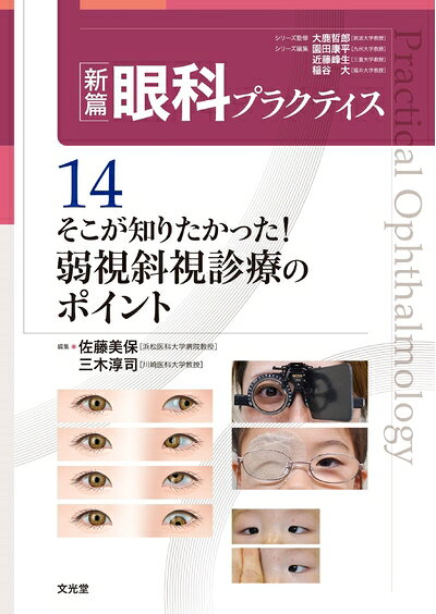【商品名】そこが知りたかった!弱視斜視診療のポイント (新篇眼科プラクティス 14)（中古品）中古本の特性上【ヤケ、破れ、折れ、メモ書き、匂い】等がある場合がございます。特に状態が【可】の場合は書き込みや破れがある場合がございますので予めご...