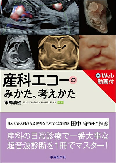【商品名】産科エコーのみかた，考えかた（中古品）中古本の特性上【ヤケ、破れ、折れ、メモ書き、匂い】等がある場合がございます。特に状態が【可】の場合は書き込みや破れがある場合がございますので予めご承知おきのほどよろしくお願いいたします。読む分...
