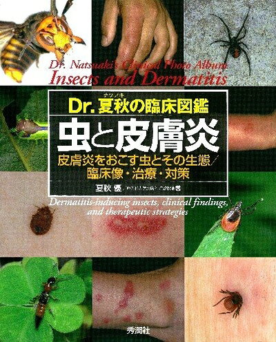 【商品名】Dr.夏秋の臨床図鑑 虫と皮膚炎（中古品）中古本の特性上【ヤケ、破れ、折れ、メモ書き、匂い】等がある場合がございます。特に状態が【可】の場合は書き込みや破れがある場合がございますので予めご承知おきのほどよろしくお願いいたします。読...