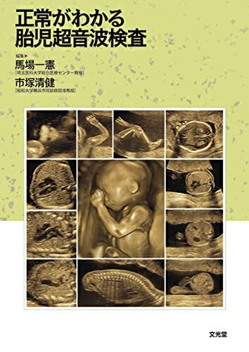 【商品名】正常がわかる胎児超音波検査（中古品）中古本の特性上【ヤケ、破れ、折れ、メモ書き、匂い】等がある場合がございます。特に状態が【可】の場合は書き込みや破れがある場合がございますので予めご承知おきのほどよろしくお願いいたします。読む分に...