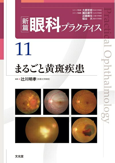 【商品名】まるごと黄斑疾患 (新篇眼科プラクティス 11)（中古品）中古本の特性上【ヤケ、破れ、折れ、メモ書き、匂い】等がある場合がございます。特に状態が【可】の場合は書き込みや破れがある場合がございますので予めご承知おきのほどよろしくお願...