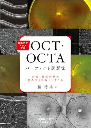 【商品名】診断力がアップする！OCT・OCTAパーフェクト読影法〜正常・異常所見の読み方と?のつけどころ（中古品）中古本の特性上【ヤケ、破れ、折れ、メモ書き、匂い】等がある場合がございます。特に状態が【可】の場合は書き込みや破れがある場合が...