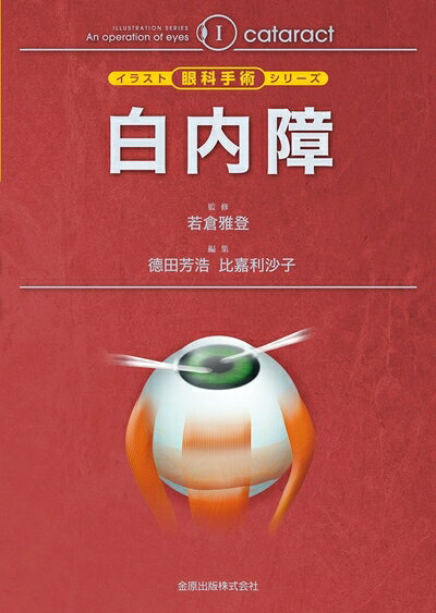 【商品名】白内障 (イラスト眼科手術シリーズ 1)（中古品）中古本の特性上【ヤケ、破れ、折れ、メモ書き、匂い】等がある場合がございます。特に状態が【可】の場合は書き込みや破れがある場合がございますので予めご承知おきのほどよろしくお願いいたし...