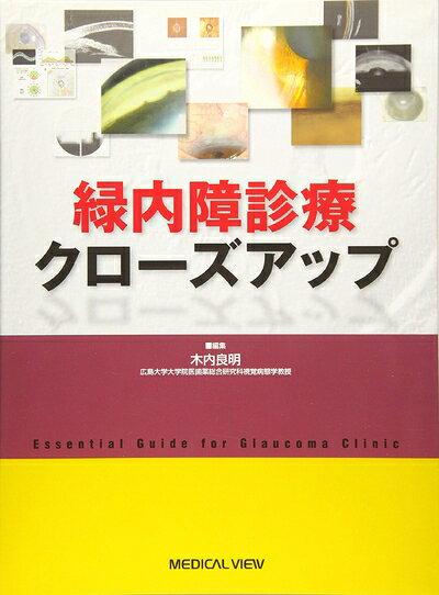 【商品名】緑内障診療クローズアップ（中古品）中古本の特性上【ヤケ、破れ、折れ、メモ書き、匂い】等がある場合がございます。特に状態が【可】の場合は書き込みや破れがある場合がございますので予めご承知おきのほどよろしくお願いいたします。読む分には...