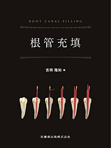 【商品名】根管充填（中古品）中古本の特性上【ヤケ、破れ、折れ、メモ書き、匂い】等がある場合がございます。特に状態が【可】の場合は書き込みや破れがある場合がございますので予めご承知おきのほどよろしくお願いいたします。読む分には問題ございません...