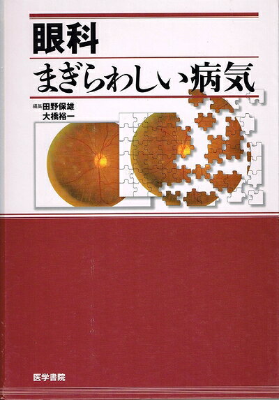 【商品名】眼科まぎらわしい病気（中古品）中古本の特性上【ヤケ、破れ、折れ、メモ書き、匂い】等がある場合がございます。特に状態が【可】の場合は書き込みや破れがある場合がございますので予めご承知おきのほどよろしくお願いいたします。読む分には問題...