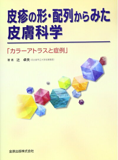 【商品名】皮疹の形・配列からみた皮膚科学 カラーアトラスと症例（中古品）中古本の特性上【ヤケ、破れ、折れ、メモ書き、匂い】等がある場合がございます。特に状態が【可】の場合は書き込みや破れがある場合がございますので予めご承知おきのほどよろしく...