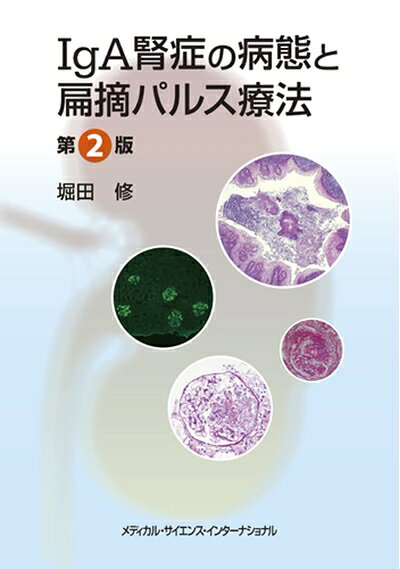 【商品名】IgA腎症の病態と扁摘パルス療法 第2版（中古品）中古本の特性上【ヤケ、破れ、折れ、メモ書き、匂い】等がある場合がございます。また、商品名に【付属、特典、○○付き、ダウンロードコード】等の記載があっても中古品の場合は基本的にこれら...