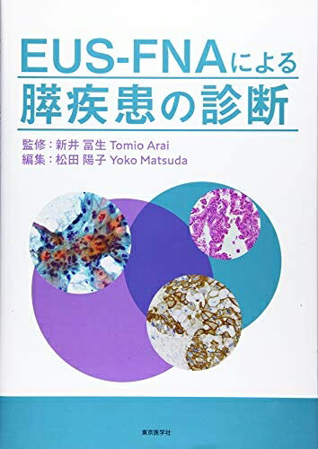 【商品名】EUS-FNAによる膵疾患の診断（中古品）中古本の特性上【ヤケ、破れ、折れ、メモ書き、匂い】等がある場合がございます。また、商品名に【付属、特典、○○付き、ダウンロードコード】等の記載があっても中古品の場合は基本的にこれらは付属致...