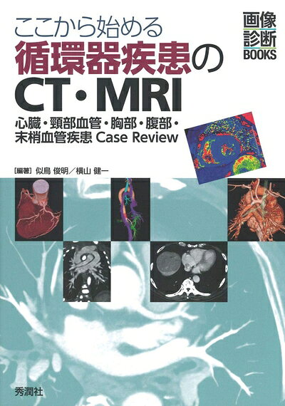 【商品名】ここから始める循環器疾患のCT・MRI (画像診断BOOKS)（中古品）中古本の特性上【ヤケ、破れ、折れ、メモ書き、匂い】等がある場合がございます。また、商品名に【付属、特典、○○付き、ダウンロードコード】等の記載があっても中古品...