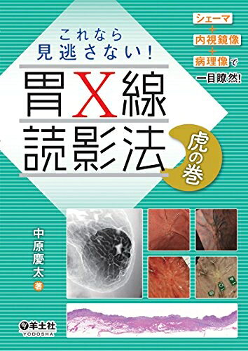【商品名】シェーマ+内視鏡像+病理像で一目瞭然! これなら見逃さない! 胃X線読影法 虎の巻（中古品）中古本の特性上【ヤケ、破れ、折れ、メモ書き、匂い】等がある場合がございます。また、商品名に【付属、特典、○○付き、ダウンロードコード】等の...