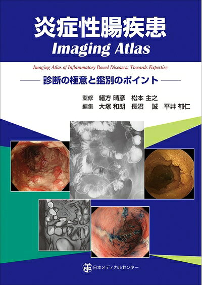 【商品名】炎症性腸疾患Imaging Atlas-診断の極意と鑑別のポイント（中古品）中古本の特性上【ヤケ、破れ、折れ、メモ書き、匂い】等がある場合がございます。また、商品名に【付属、特典、○○付き、ダウンロードコード】等の記載があっても中...
