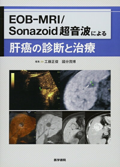 【商品名】EOB-MRI/Sonazoid 超音波による肝癌の診断と治療（中古品）中古本の特性上【ヤケ、破れ、折れ、メモ書き、匂い】等がある場合がございます。また、商品名に【付属、特典、○○付き、ダウンロードコード】等の記載があっても中古品...