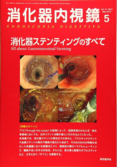 【商品名】消化器内視鏡 (Vol.31 No.5(2019 May))（中古品）中古本の特性上【ヤケ、破れ、折れ、メモ書き、匂い】等がある場合がございます。また、商品名に【付属、特典、○○付き、ダウンロードコード】等の記載があっても中古品の...