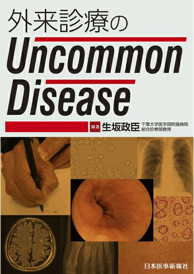 【商品名】外来診療のUncommon Disease（中古品）中古本の特性上【ヤケ、破れ、折れ、メモ書き、匂い】等がある場合がございます。また、商品名に【付属、特典、○○付き、ダウンロードコード】等の記載があっても中古品の場合は基本的にこれ...