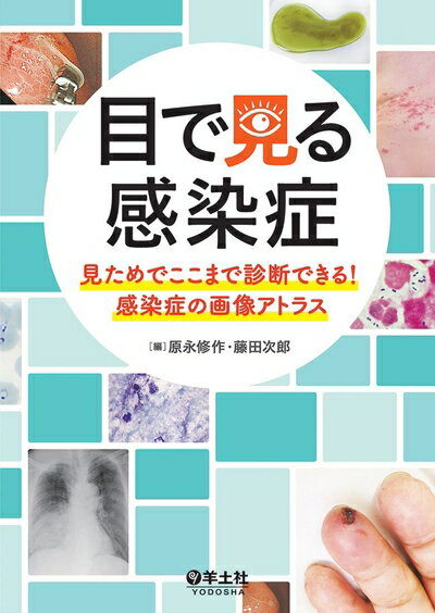 【商品名】目で見る感染症〜見ためでここまで診断できる！感染症の画像アトラス（中古品）中古本の特性上【ヤケ、破れ、折れ、メモ書き、匂い】等がある場合がございます。また、商品名に【付属、特典、○○付き、ダウンロードコード】等の記載があっても中古...