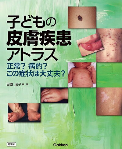 【商品名】子どもの皮膚疾患アトラス: 正常?病的?この症状は大丈夫?（中古品）中古本の特性上【ヤケ、破れ、折れ、メモ書き、匂い】等がある場合がございます。また、商品名に【付属、特典、○○付き、ダウンロードコード】等の記載があっても中古品の場...