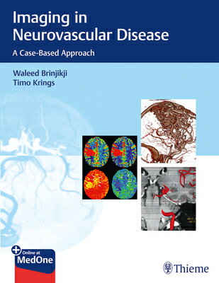 IMAGING IN NEUROVASCULAR DISEA Waleed Brinjikji Timo Krings THIEME MEDICAL PUBL INC2019 Paperback English ISBN：978168420...