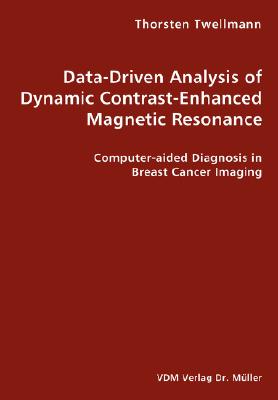 DATAーDRIVEN ANALYSIS OF DYNAMI Thorsten Twellmann VDM VERLAG2007 Paperback English ISBN：9783836433167 洋書 Computers & Sci...