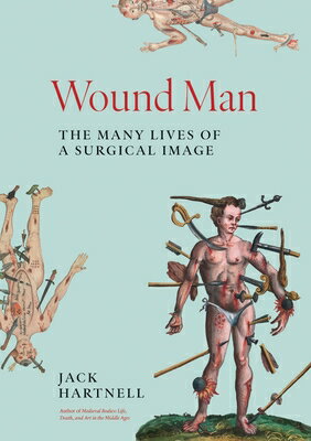 WOUND MAN Jack Hartnell PRINCETON UNIV PR2025 Hardcover English ISBN：9780691243481 洋書 Computers & Science（コンピューター＆科学） Me...