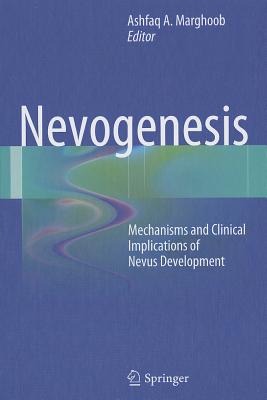 NEVOGENESIS Ashfaq A. Marghoob SPRINGER NATURE2012 Hardcover English ISBN：9783642283963 洋書 Computers & Science（コンピューター＆科...
