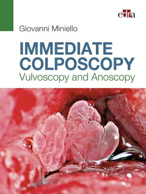 IMMEDIATE COLPOSCOPY ー VULVOSC Giovanni Miniello EDRA MEDIA LLC2021 Paperback English ISBN：9788821455124 洋書 Computers & ...