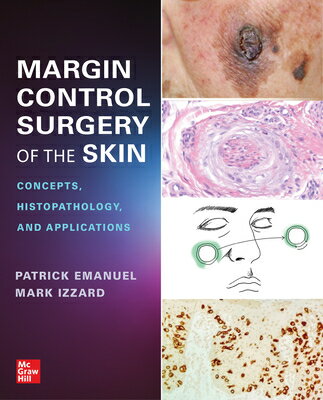MARGIN CONTROL SURGERY OF THE Patrick Emanuel Mark Izzard MCGRAW HILL EDUCATION & MEDIC2023 Paperback English ISBN：97812...