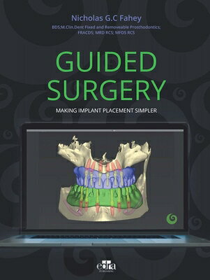 GUIDED SURGERY ー MAKING IMPLAN G. C. Fahey Nicholas EDRA MEDIA LLC2022 Hardcover English ISBN：9781737126171 洋書 Computers...