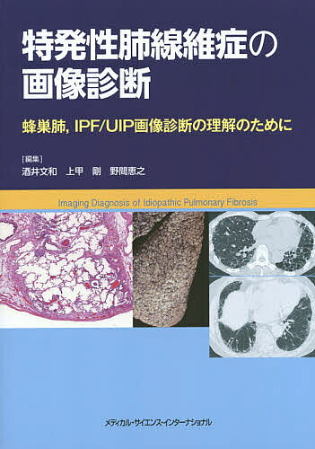 著者酒井文和(編集) 上甲剛(編集) 野間恵之(編集)出版社メディカル・サイエンス・インターナショナル発売日2015年08月ISBN9784895928243ページ数262Pキーワードとくはつせいはいせんいしようのがぞうしんだんほうそ トク...