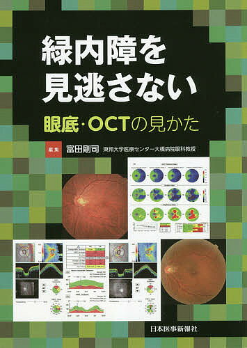 著者富田剛司(編集)出版社日本医事新報社発売日2018年02月ISBN9784784962372ページ数118Pキーワードりよくないしようおみのがさないがんていおーしーてい リヨクナイシヨウオミノガサナイガンテイオーシーテイ とみた ごうじ...