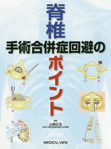 ※商品画像はイメージや仮デザインが含まれている場合があります。帯の有無など実際と異なる場合があります。著者山崎正志(編集)出版社メジカルビュー社発売日2019年05月ISBN9784758318686ページ数297Pキーワードせきついしゆじ...