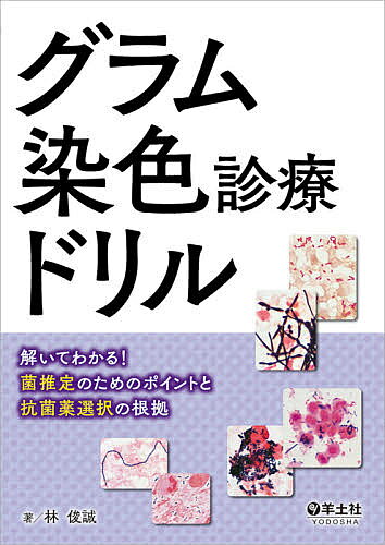 ※商品画像はイメージや仮デザインが含まれている場合があります。帯の有無など実際と異なる場合があります。著者林俊誠(著)出版社羊土社発売日2021年07月ISBN9784758123747ページ数230Pキーワードぐらむせんしよくしんりようど...