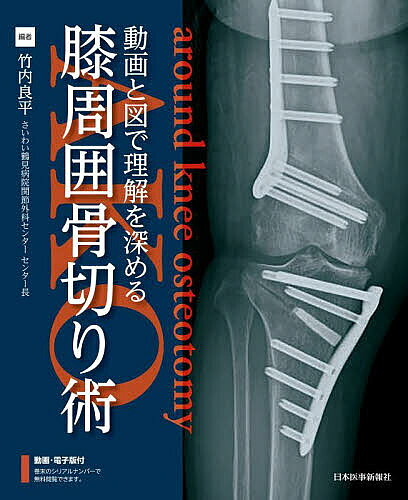 著者竹内良平(編)出版社日本医事新報社発売日2022年12月ISBN9784784969500ページ数135Pキーワードどうがとずでりかいおふかめる ドウガトズデリカイオフカメル たけうち りようへい タケウチ リヨウヘイ978478496...