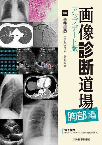 著者金井信恭(編著)出版社日本医事新報社発売日2023年01月ISBN9784784924110ページ数194Pキーワードがぞうしんだんどうじようきようぶへんあつぷでーとば ガゾウシンダンドウジヨウキヨウブヘンアツプデートバ かない のぶや...