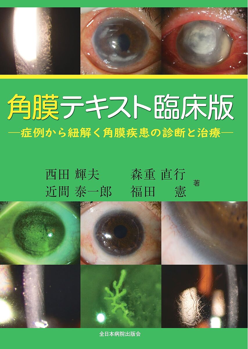※商品画像はイメージや仮デザインが含まれている場合があります。帯の有無など実際と異なる場合があります。著者西田輝夫(ほか著)出版社全日本病院出版会発売日2024年09月ISBN9784865198263ページ数215Pキーワードかくまくてき...