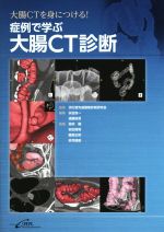 消化管先進画像診断研究会【監修】，永田浩一，遠藤俊吾【編】，高林健，安田貴明，藤原正則，岩月建磨【執筆】販売会社/発売会社：シービーアール発売年月日：2014/09/15JAN：9784908083006／／付属品〜DVD−ROM2枚付