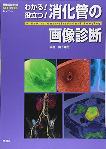 【30日間返品保証】商品説明に誤りがある場合は、無条件で弊社送料負担で商品到着後30日間返品を承ります。【最短翌日到着】正午12時まで（日曜日は午前9時まで）の注文は当日発送（土日祝も発送）。関東・関西・中部・中国・四国・九州地方は翌日お届...