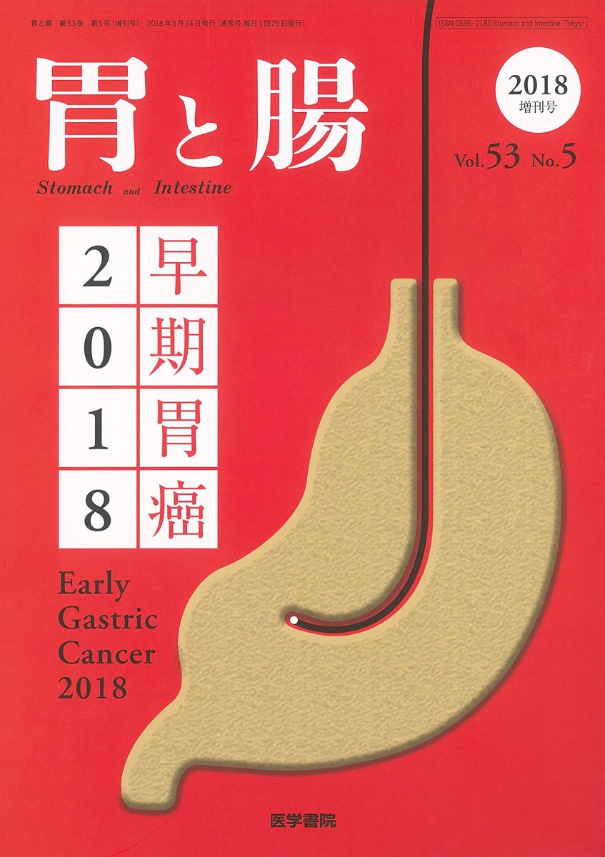 【30日間返品保証】商品説明に誤りがある場合は、無条件で弊社送料負担で商品到着後30日間返品を承ります。【最短翌日到着】正午12時まで（日曜日は午前9時まで）の注文は当日発送（土日祝も発送）。関東・関西・中部・中国・四国・九州地方は翌日お届...