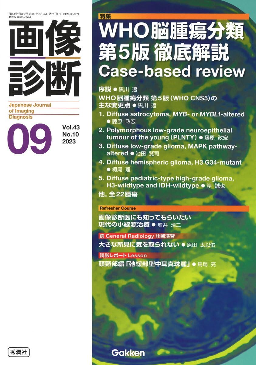 【30日間返品保証】商品説明に誤りがある場合は、無条件で弊社送料負担で商品到着後30日間返品を承ります。【最短翌日到着】正午12時まで（日曜日は午前9時まで）の注文は当日発送（土日祝も発送）。関東・関西・中部・中国・四国・九州地方は翌日お届...