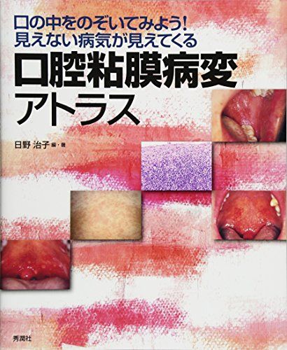 【30日間返品保証】商品説明に誤りがある場合は、無条件で弊社送料負担で商品到着後30日間返品を承ります。【最短翌日到着】正午12時まで（日曜日は午前9時まで）の注文は当日発送（土日祝も発送）。関東・関西・中部・中国・四国・九州地方は翌日お届...