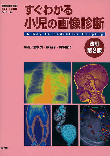 著者荒木力(編著) 原裕子(編著) 野坂俊介(編著)出版社学研メディカル秀潤社発売日2017年04月ISBN9784780909012ページ数609Pキーワードすぐわかるしようにのがぞうしんだんがぞう スグワカルシヨウニノガゾウシンダンガゾ...