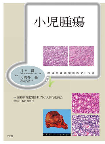 ※商品画像はイメージや仮デザインが含まれている場合があります。帯の有無など実際と異なる場合があります。著者井上健(編集) 大喜多肇(編集) 腫瘍病理鑑別診断アトラス刊行委員会(監修)出版社文光堂発売日2026年03月ISBN97848306...