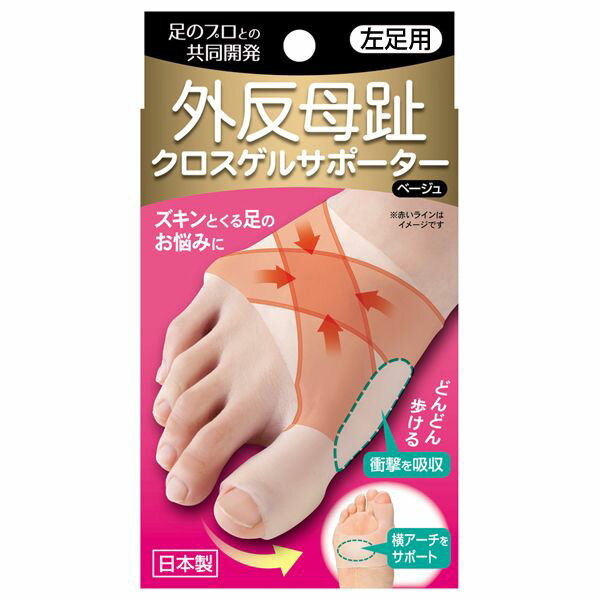 アルファックス06-4792-1193【商品説明】■クロスラインが親指をやさしく広げ、さらに親指横クッションが付け根のつらい摩擦や痛みをケアします。■同時に足裏のクッションが弛んだ横アーチを支え、足の負担を軽減します。■適応サイズ／重量（約...