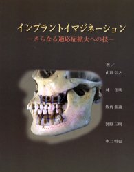 ■ジャンル：医学＞全般＞全般■ISBN：9784874178331■商品名：インプラントイマジネーション さらなる適応症拡大への技 山道信之/著 林佳明/著 牧角新蔵/著 河原三明/著 水上哲也/著★日時指定・銀行振込・コンビニ支払を承るこ...