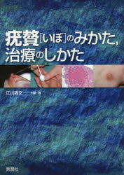 ■ジャンル：医学＞臨床医学内科系＞皮膚科学■ISBN：9784780909470■商品名：疣贅(いぼ)のみかた，治療のしかた 江川清文/編・著★日時指定・銀行振込・コンビニ支払を承ることのできない商品になりますタイトル【新品】【本】疣贅(い...