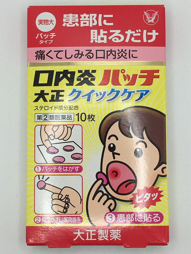 ※ご注意※　【指定第2類医薬品】をご購入の方へ 本品は指定第2類医薬品です。使用上の注意(禁忌)を必ずご確認下さい。 ご不明な点がございましたら当店の登録販売者までご相談下さい。 □商品説明 ●口内炎パッチ大正クイックケアは、「貼る」口内炎...