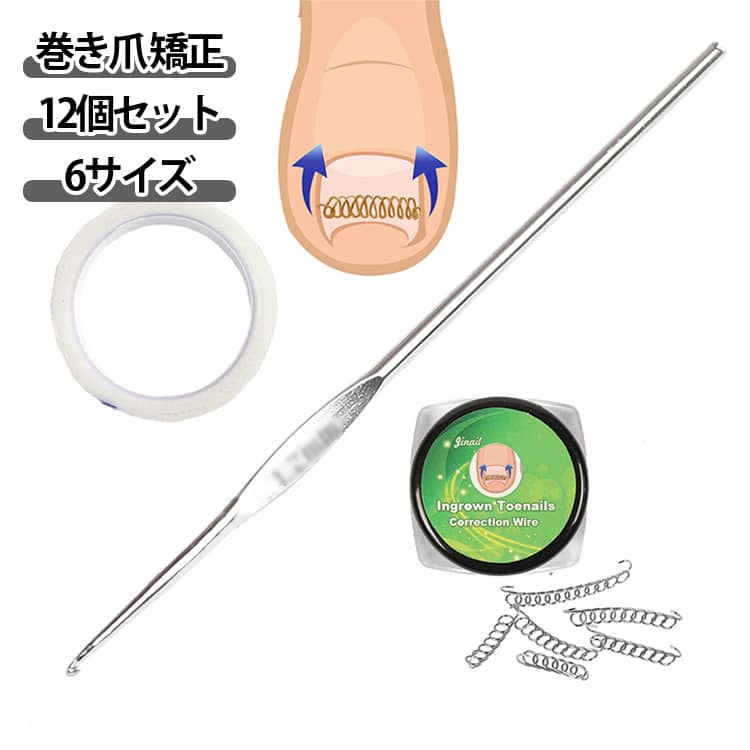 【12個セット】【6サイズ】自分で巻き爪のセルフ矯正！痛い巻き爪のお悩みに！加工不要の巻き爪・陥入爪の矯正器具ですぐに使えます。普通・軽度巻き爪・中等巻き爪・重度巻き爪・片側巻き爪など、すべてのタイプの巻き爪に使用可能。シャワー可能/移動可...