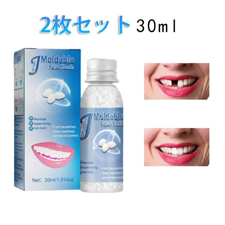 【2本セット】【一時的な歯の補修に】欠けた歯やすき間が気になるときに、応急的にカバーできる補修キット。見た目を自然に整えたい場面や、外出時のエチケット対策としても便利です。【お湯で簡単カスタマイズ】ぬるま湯に入れると柔らかくなり、自由に形を...