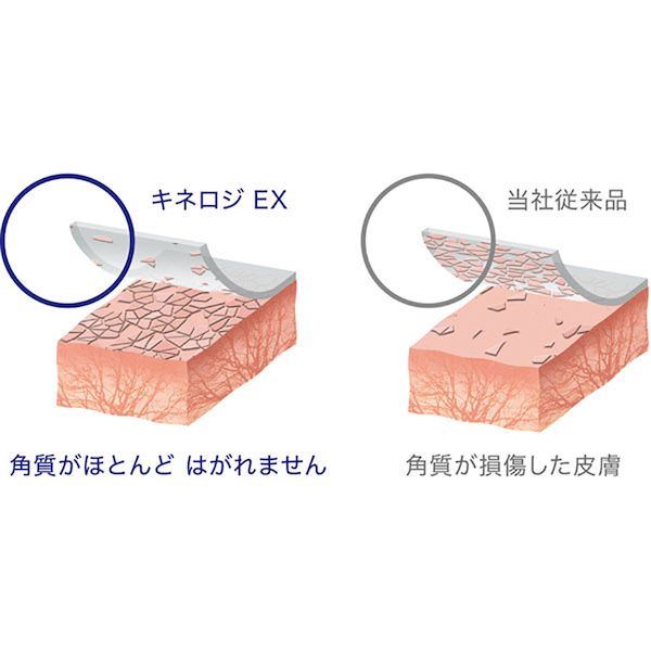 【商品説明】入数/ボックス：12ロール ※1ケース（外箱）20ボックス入り 、特徴（1）角質剥離を抑える独自開発の粘着剤を使用しており、肌に優しく貼り直しも可能です。特徴（2）動きへの追従性がUPしたはがれにくいテープです。その他テーピング...