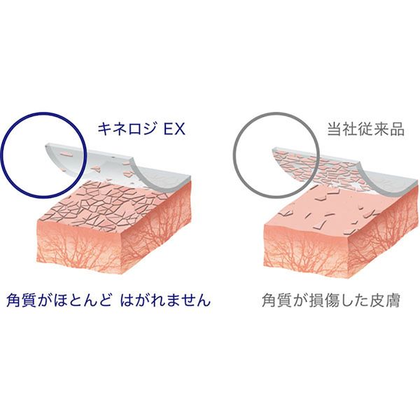 【商品説明】入数/ボックス：6ロール ※1ケース（外箱）20ボックス入り 、特徴（1）角質剥離を抑える独自開発の粘着剤を使用しており、肌に優しく貼り直しも可能です。特徴（2）動きへの追従性がUPしたはがれにくいテープです。その他テーピング用...